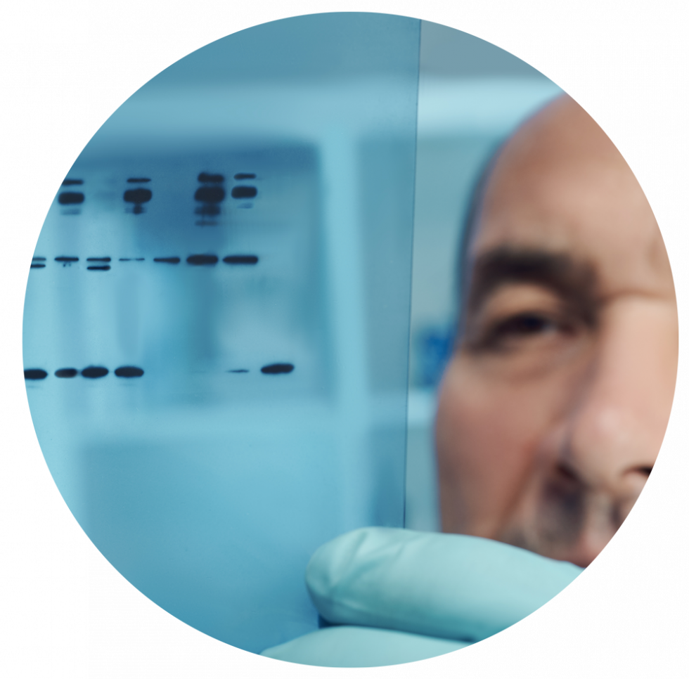 Western Blotting Applications with FluoroFinder
