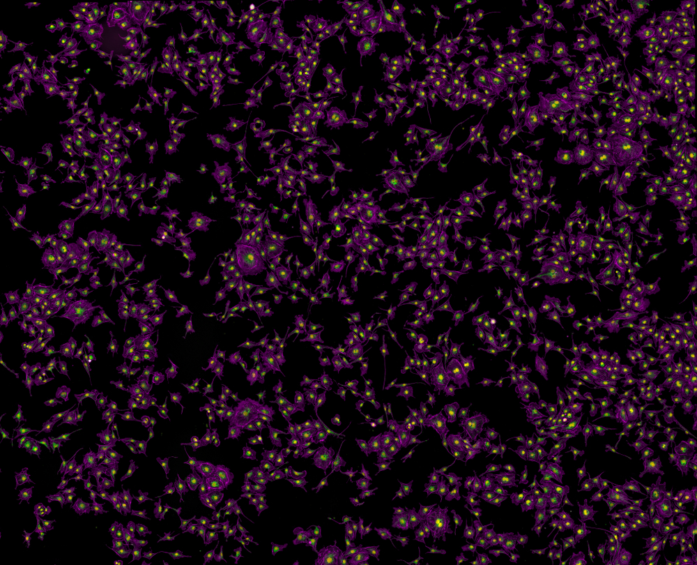 Newsletter: Tyramide Signal Amplification in Microscopy and Spatial ...