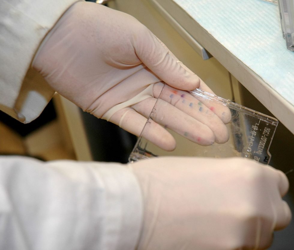Advances in Western Blot Technologies - FluoroFinder