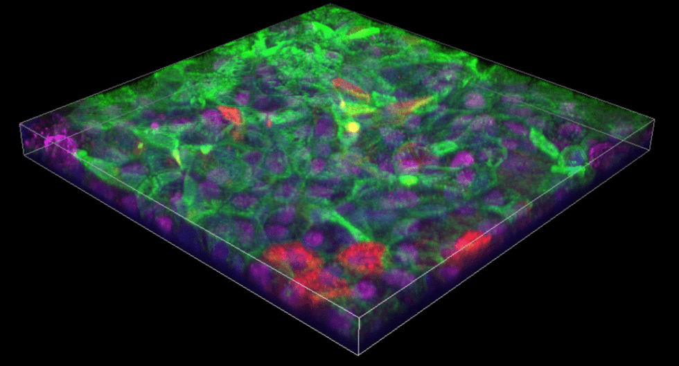 Confocal vs Super-Resolution Microscopy - FluoroFinder