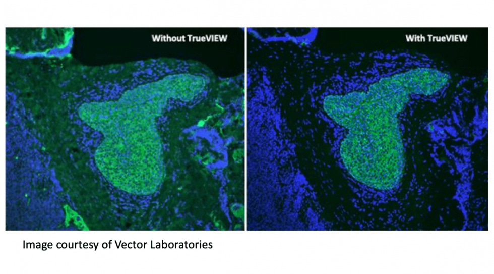 Tips to Minimize Autofluorescence - FluoroFinder