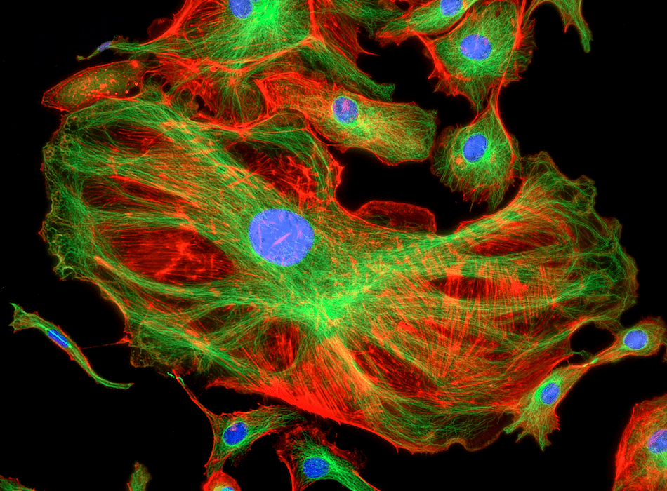 Picture Perfect: Capturing a High-Quality Fluorescent Microscopy Image ...