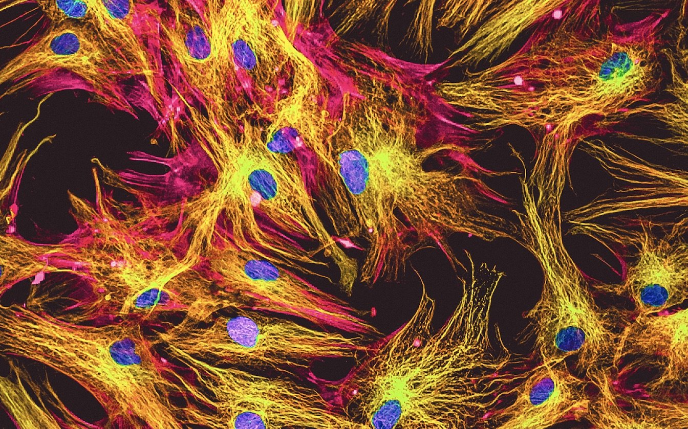 Choosing the Right Fluorescent Immunoassay for Your Research - FluoroFinder