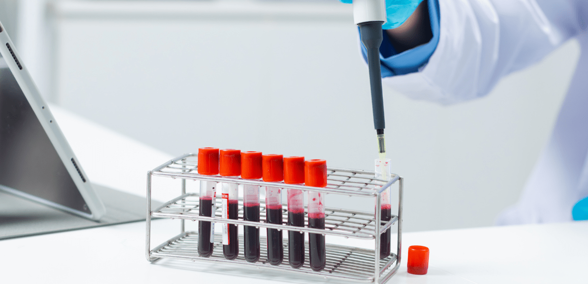 Flow Cytometry Sample Preparation | FluoroFinder
