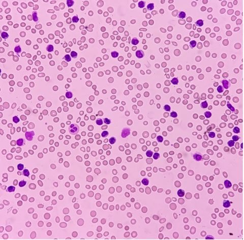 What Is the Difference Between IHC, ICC, and IF?